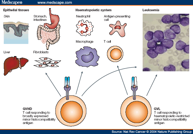 Molecules and Mechanisms of the Graft-Versus-Leukemia Effect