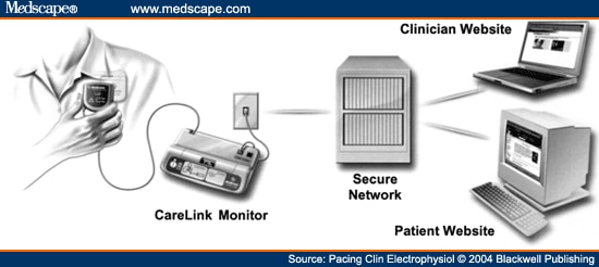 Carelink Smartsync Us By Medtronic Inc Medtronic MyCareLink Patient ...