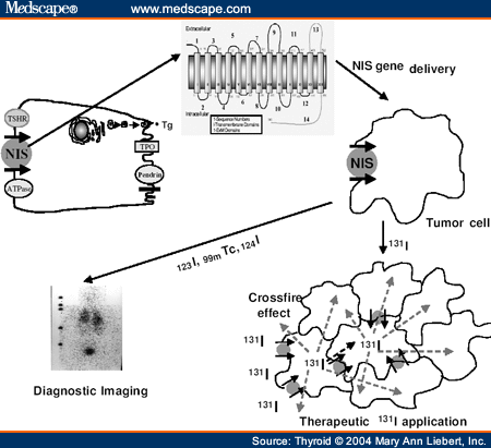 Gene Therapy for Thyroid Cancer - Page 4