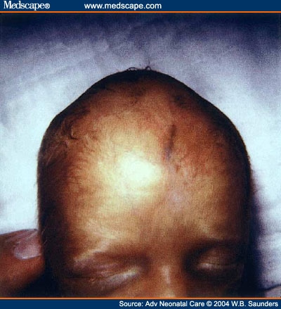 Systematic Physical Assessment Guide - Infected/Septic Infants - Page 6