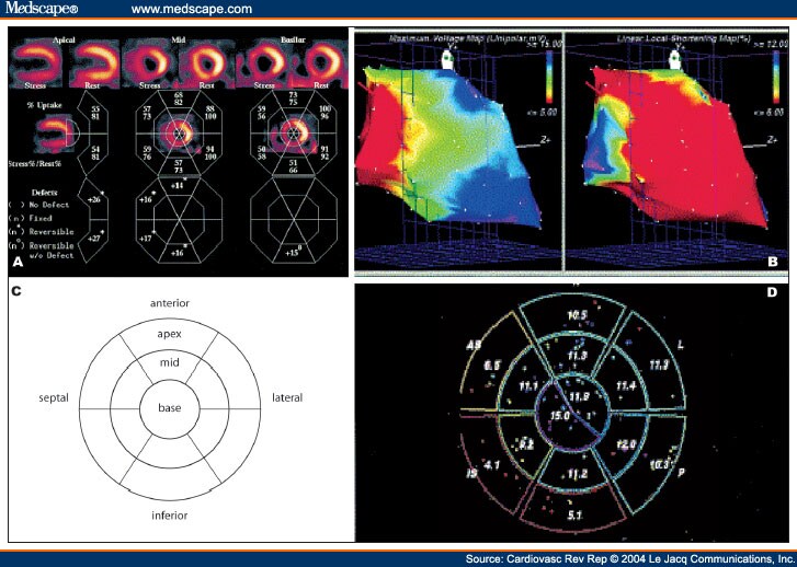 Diagnostic Applications of Electromechanical Mapping - Page 2