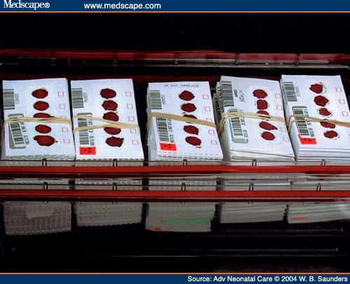 A Primer on Newborn Screening - Page 5