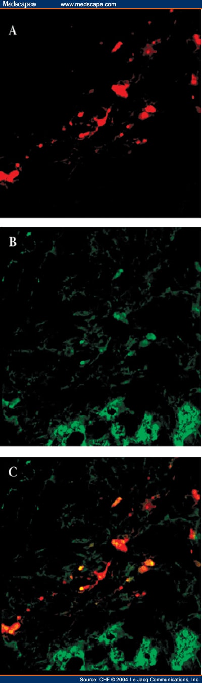 Stem Cell Therapy for the Heart - Page 6