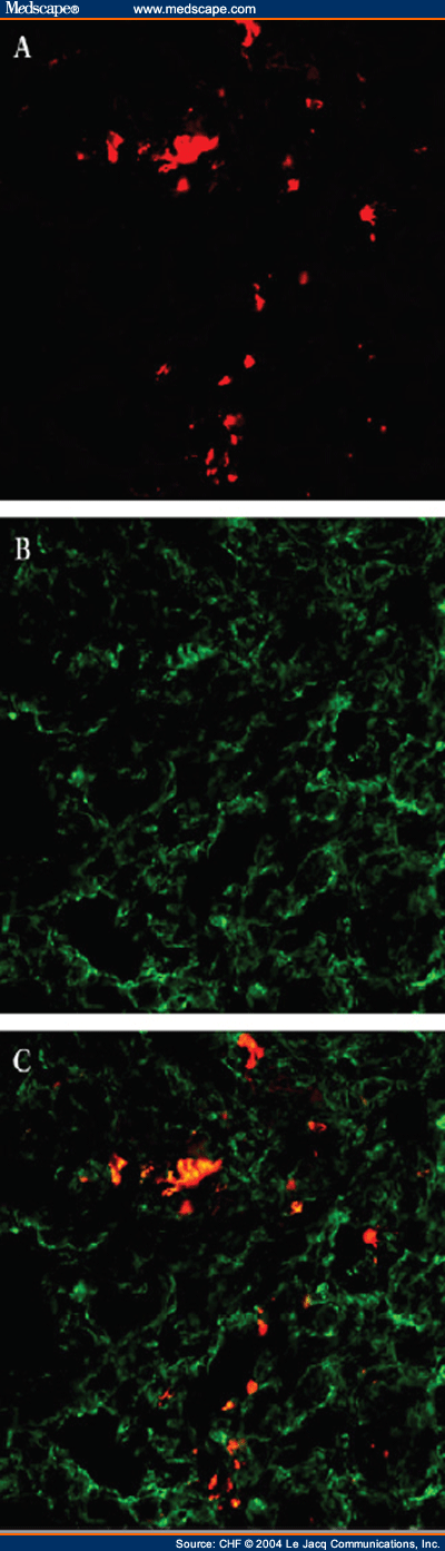 Stem Cell Therapy for the Heart - Page 6