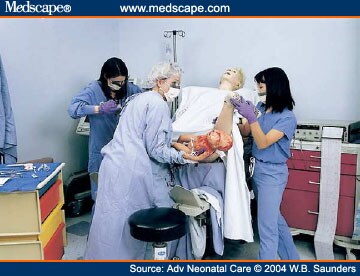 High Fidelity Simulation-Based Training in Neonatal Nursing - Page 5