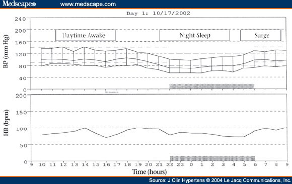 Ambulatory Blood Pressure Monitoring for Every Hypertensive