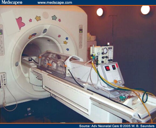 Ensuring Safety for Infants Undergoing MRI - Page 12