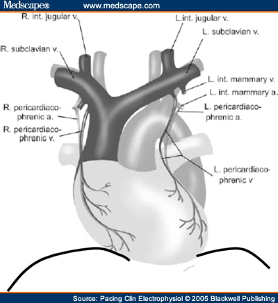 Surgical Lv Lead Placement | semashow.com