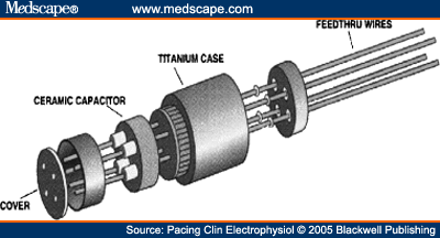 Is Magnetic Resonance Imaging Safe in Cardiac Pacemaker - Page 4