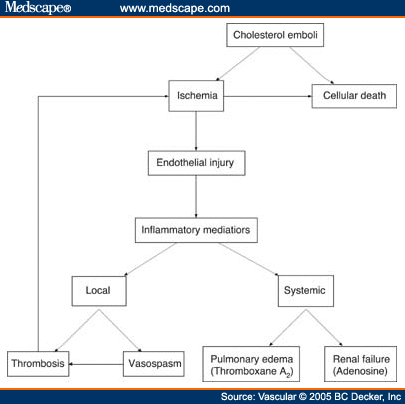 Distal Peripheral Microembolism - Page 4