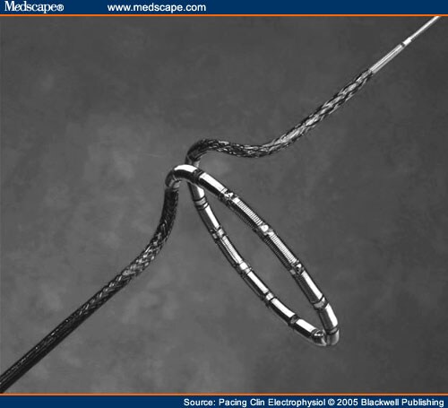 Alternative Energy Sources for the Ablation of Arrhythmias - Page 3