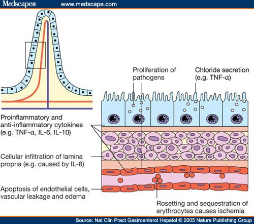 Diarrhea Caused by Primarily Non-Gastrointestinal Infections - Page 2