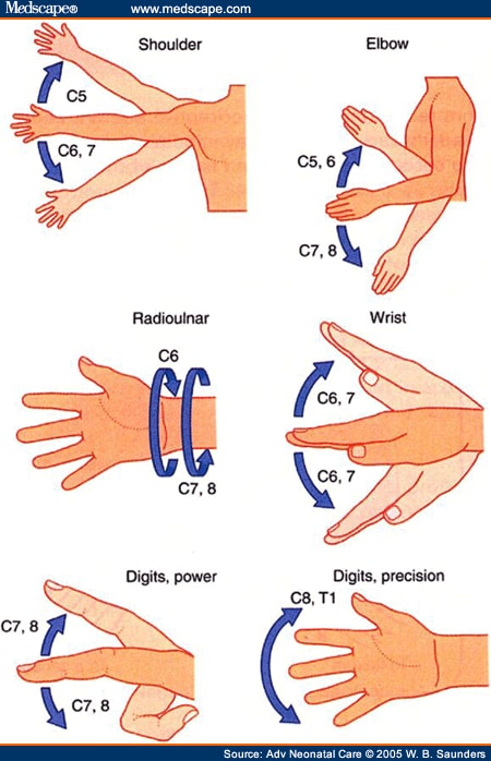 Injuries to the Brachial Plexus: Mechanisms and Risk Factors - Page 2