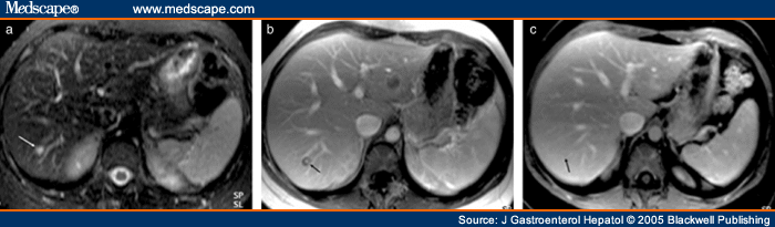 Focal Lesions in Normal Liver - Page 4