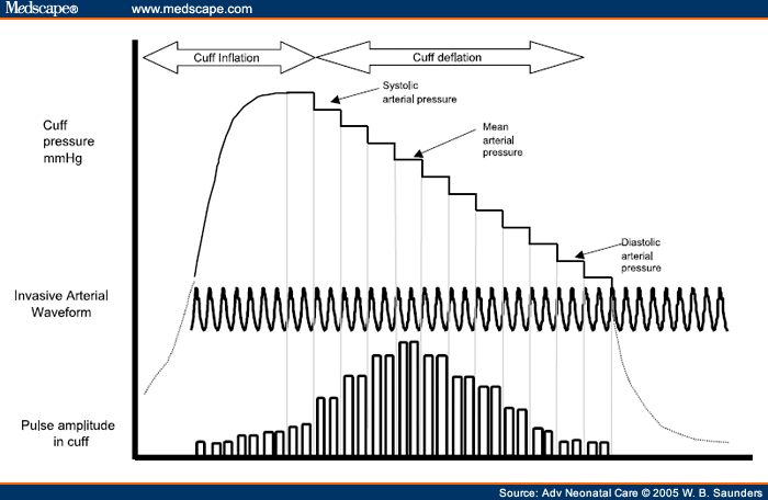 Basic Principles of Noninvasive BP Measurement in Infants - Page 3