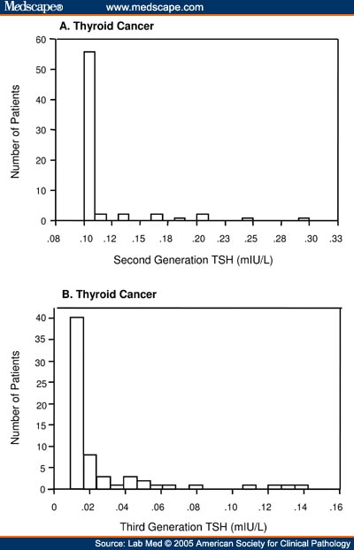 New Guideline For Tsh Thyroid Stimulating Hormone Endocrine system 1
