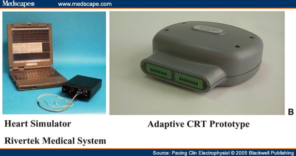 Adaptive Cardiac Resynchronization Therapy Device - Page 2