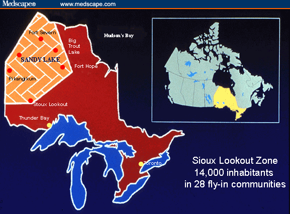 Diabetes in Aboriginal Canadians