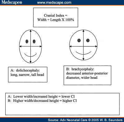 Impacting Infant Head Shapes - Page 2