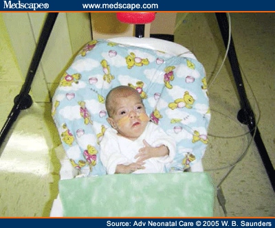 Impacting Infant Head Shapes - Page 4