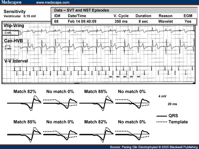 Advanced ICD Troubleshooting: Part I - Page 4