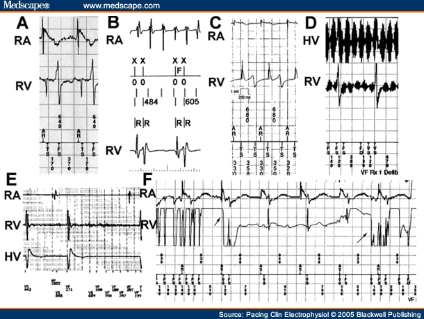 Advanced ICD Troubleshooting: Part I - Page 2