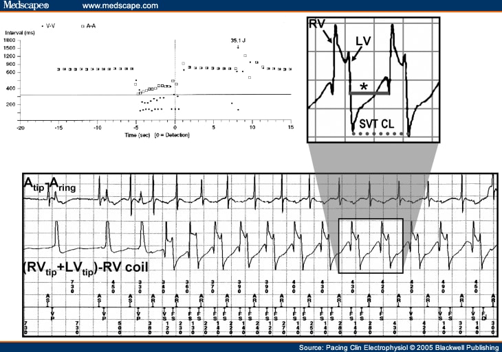 Advanced ICD Troubleshooting: Part I - Page 2