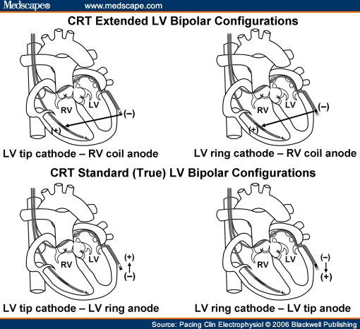 Advanced ICD Troubleshooting: Part II - Page 5