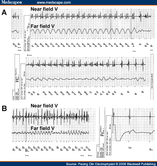 Advanced ICD Troubleshooting: Part II - Page 6