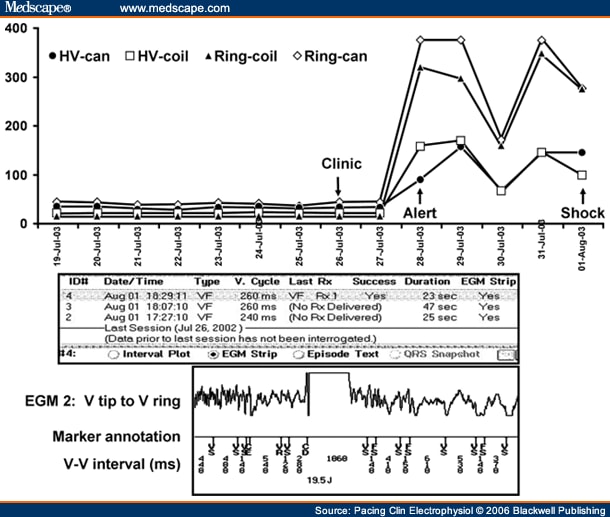 Advanced ICD Troubleshooting: Part II - Page 3