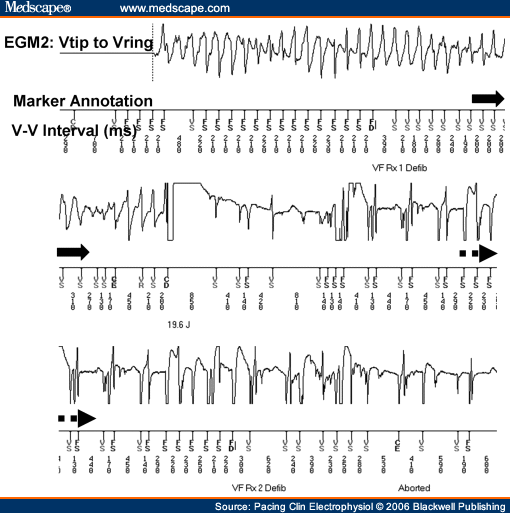 Advanced ICD Troubleshooting: Part II - Page 3