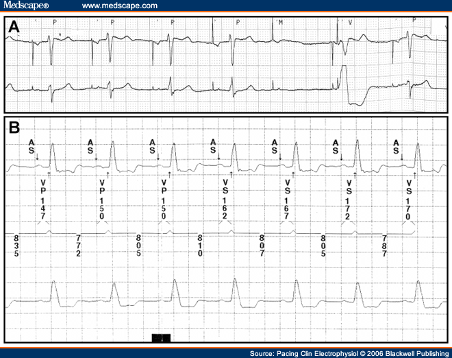 Advanced ICD Troubleshooting: Part II - Page 4
