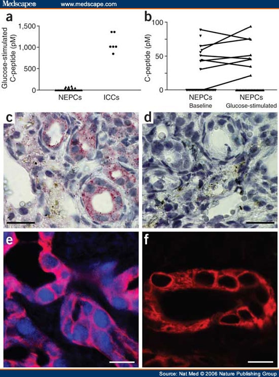 Beta-Cell Differentiation From Nonendocrine Epithelial Cells - Page 2