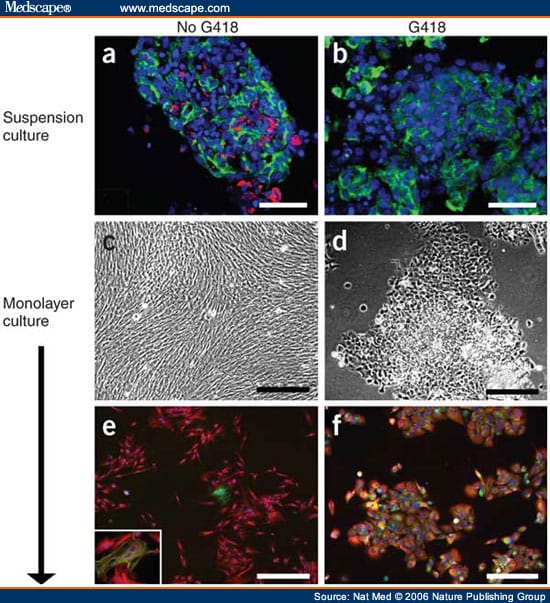 Beta-Cell Differentiation From Nonendocrine Epithelial Cells - Page 2