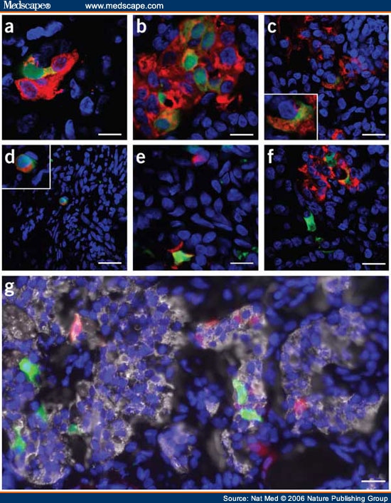 Beta-Cell Differentiation From Nonendocrine Epithelial Cells - Page 2