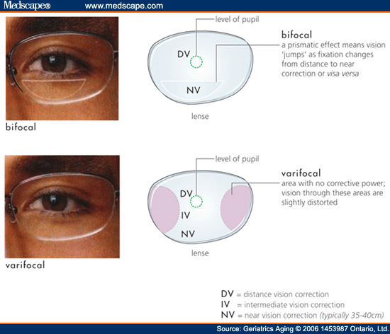 Ophthalmic Interventions to Help Prevent Falls - Page 3