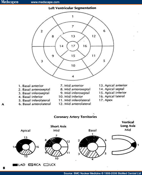 Frequency and Severity of Myocardial Perfusion Abnormalities - Page 2