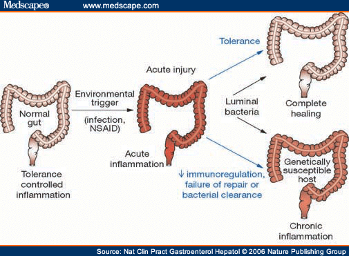 Pathogenesis of Crohn's Disease and Ulcerative Colitis - Page 7
