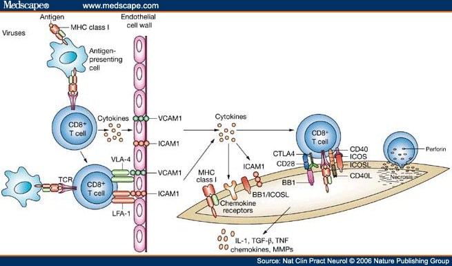 Sporadic Inclusion Body Myositis - Page 4
