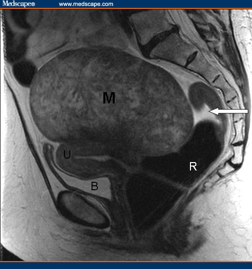 Role of CT Scanning in Women's Health