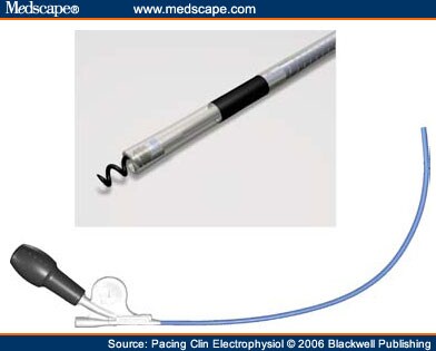 Lumenless, Catheter-Delivered, Bipolar, Permanent Pacemaker Lead - Page 2
