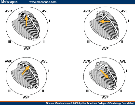 Recognizing Those Electrocardiograms That Distinguish You Smart Clinician