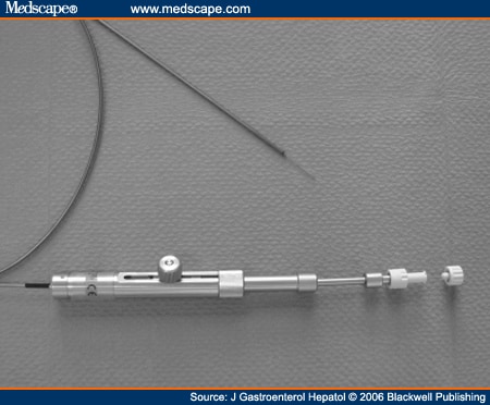 Endoscopic Ultrasound-Guided Fine Needle Aspiration Biopsy - Page 2
