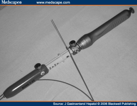 Endoscopic Ultrasound-Guided Fine Needle Aspiration Biopsy - Page 2