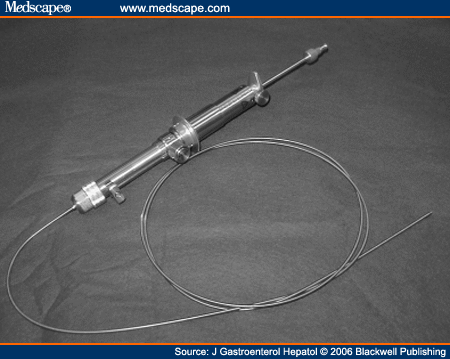 Endoscopic Ultrasound-Guided Fine Needle Aspiration Biopsy - Page 2