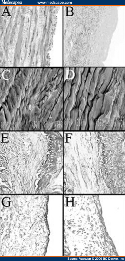 Development of a Tissue-Engineered Bypass Graft Seeded with Stem Cells ...
