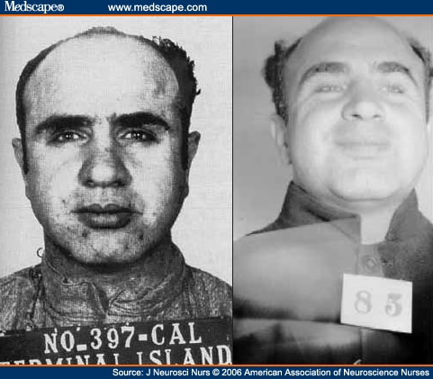 Neurological Correlates of High-Risk Behavior: Alphonse Capone Case ...
