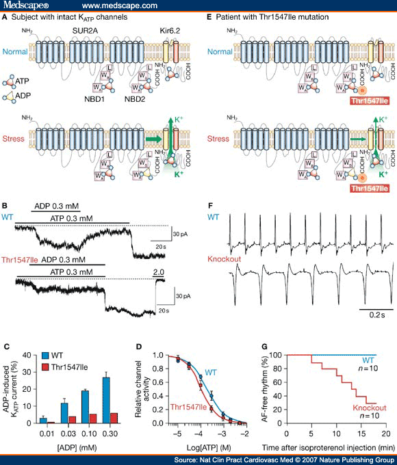 KATP Channel Mutation Confers Risk for Adrenergic AF