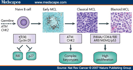 Genetic and Molecular Pathogenesis of Mantle Cell Lymphoma