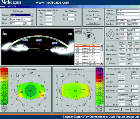 Advances in Ocular Imaging - Page 3